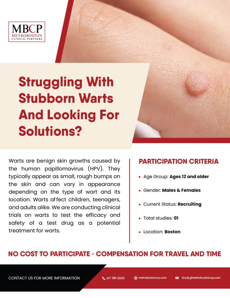 Dermatology Clinical Trials in Boston, Massachusetts | MBCP