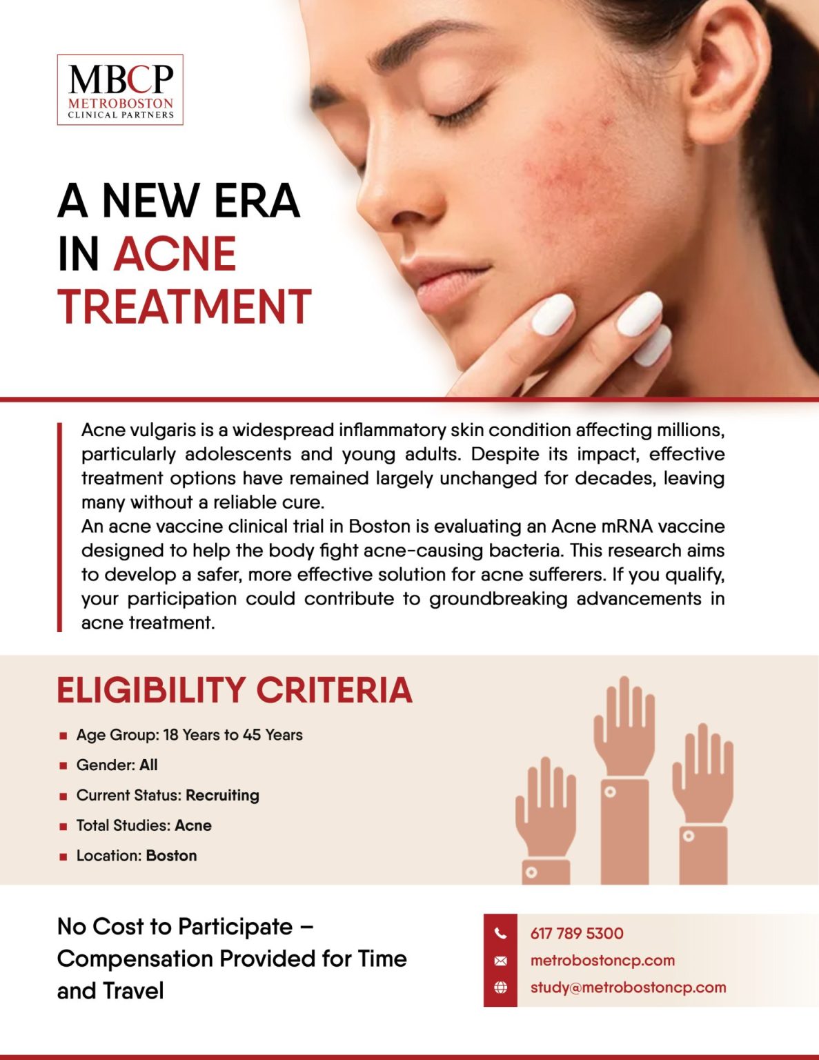 Join the Acne Vaccine Clinical Trial in Boston